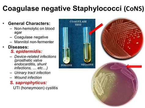 Staphylococci Prac Microbiology