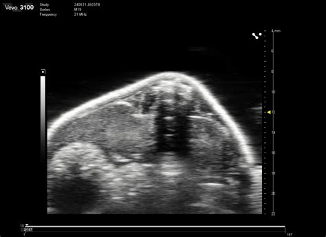 Tumorsegmentation Instance Segmentation Dataset And Pre Trained Model By Agares