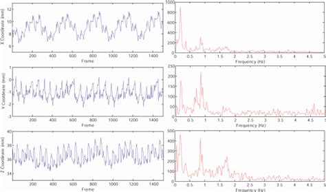 Results For In Vivo Robotic Assisted Mis A The Recovered 3d Download Scientific Diagram