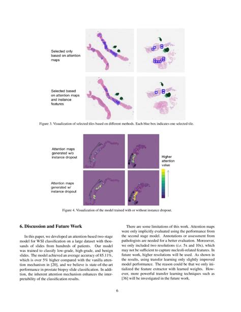 An Attention Based Multi Resolution Model For Prostate Whole Slide Imageclassification And