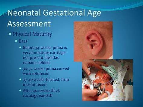 Ppt Neonatal Gestational Age Assessment Powerpoint Presentation Free Download Id353658