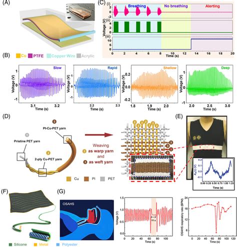 Healthcare Monitoring By Respiration‐driven Tengs A Schematic Image Download Scientific