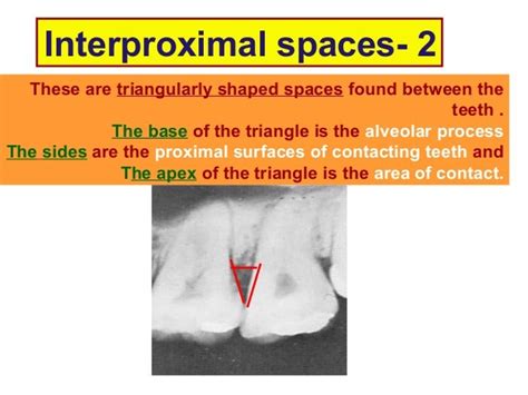 Direct Factors And Their Significeance In Protection Of Periodontium