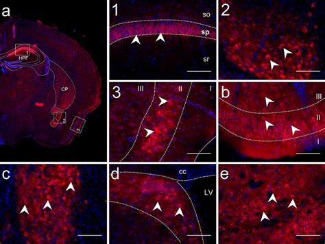Immunohistological Analysis Of Mouse Brain Sections Revealed A Limited Download Scientific
