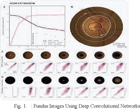 figure 1 from automated detection of glaucoma from fundus images using