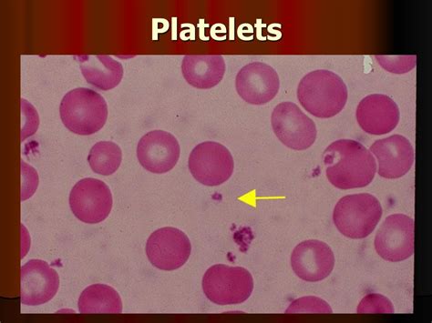 Thrombosis And Embolism Ppt Download
