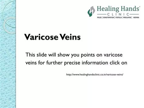 Ppt Varicose Veins Causes Symptoms And Treatment Powerpoint Presentation Id