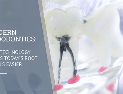 Crown Or No Crown What Happens After A Root Canal Eastern Idaho