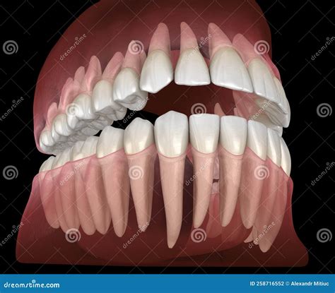 Morphology Of Human Teeth Stock Illustration Illustration Of Denture 258716552