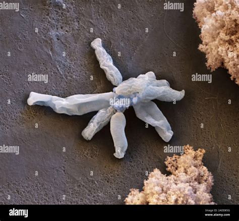 Phototrophic Iron Oxidizing Bacteria And Magnetite Coloured Scanning Electron Micrograph Sem