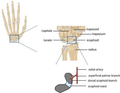 Preliminary Evidence That Bilateral Scaphoid Symmetry Is Not Affected By Hand Dominance Or