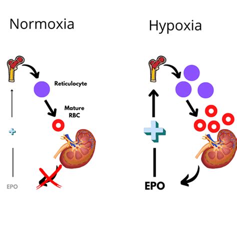 Erythropoietin Test At Affordable Price Ganesh Diagnostic