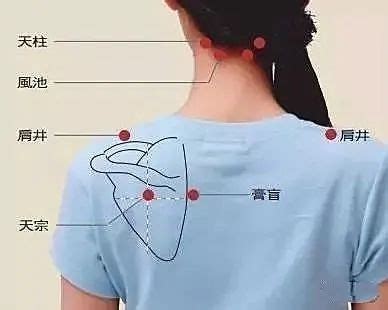 当心！这些常见症状，都可能是颈椎病…… 福建中医药大学泉州正骨医院