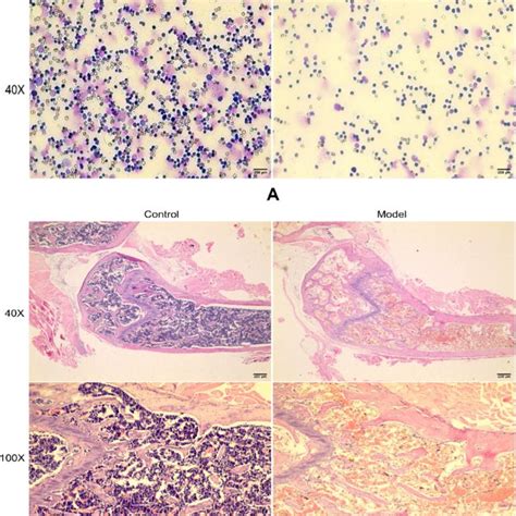 Bone Marrow Proliferation Among Group Control And Model On Day 1