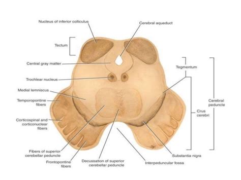 Midbrain Neuroradiology