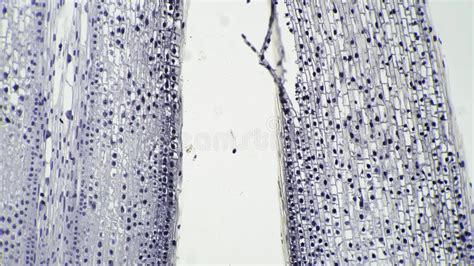 Root Tip Of Allium Cepa In Longitudinal Section Magnified By Microscope 100x On Bright Field