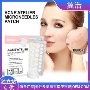 OUHOE痘痘贴 面部泛红修护痘痘粉刺清洁毛孔滋润平滑肌肤净痘贴片 阿里巴巴