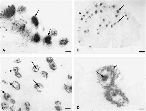A±d Histoblot Analysis Of Prp Sc Accumulation In Lymphoid Tissues From Download Scientific