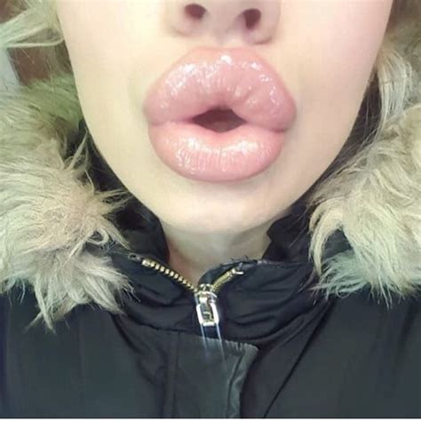 Perfect Blowlips 001 Porn Pictures Xxx Photos Sex Images 3660241
