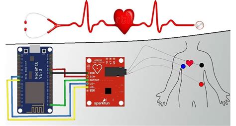 Iot Ecg Monitoring With Ad8232 Ecg Sensor And Esp8266