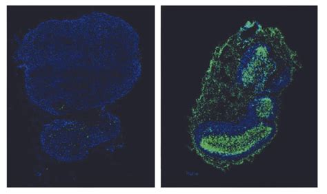 Black Sheep Immune Cells Activated To Eliminate Tumors In Laboratory Mice News Center