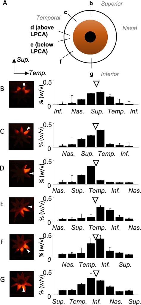 Structure Of Suprachoroidal Space Semantic Scholar