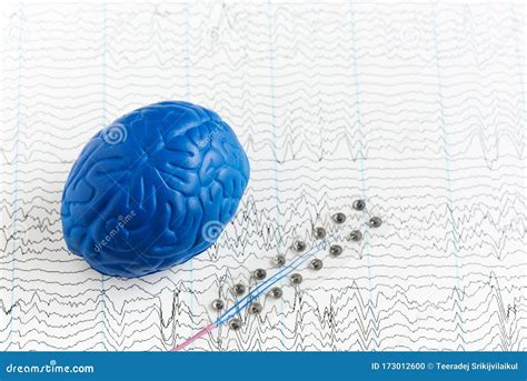 Subdural Grid Electrode For Brain Waves Recording On The Base Of Brain Stock Image