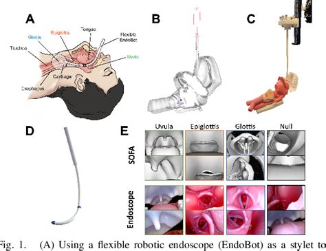 Figure 1 From Sim To Real Segmentation In Robot Assisted Transoral Tracheal Intubation