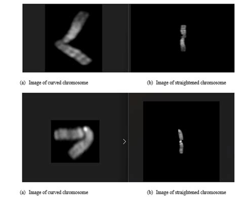 Chromosome Classification Using Deep Learning Technique