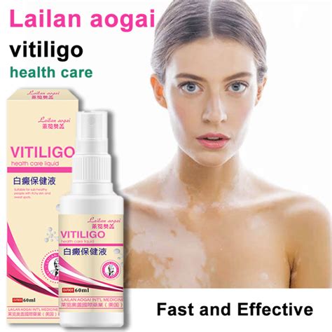 【vitiligo Nemesis】vitiligo Treatment Cream Vitiligo Remover Vitiligo Cream Vitiligo Ointment An
