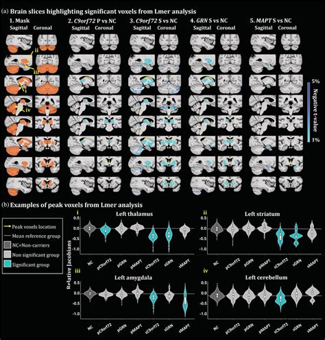 A Brain Slices Of The Brain Highlighting Significant Group Download Scientific Diagram