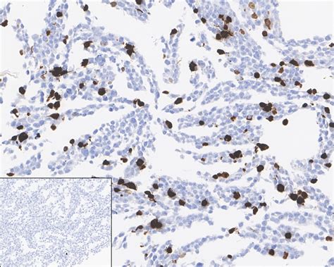 Cre Recombinase Recombinant Rabbit Monoclonal Antibody [psh01 93] Ha7