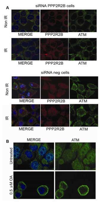 Lack Of Ppp2r2b Prevents Atm Nuclear Import A Wsuhn 13 Cells Were