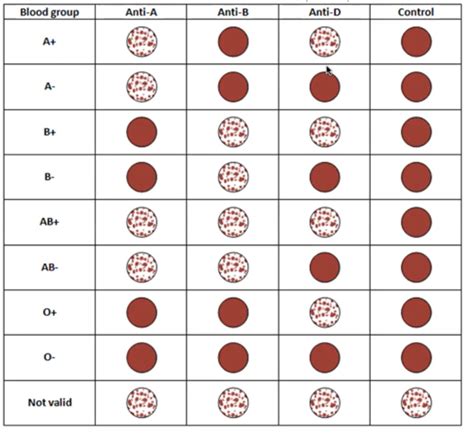 Physiology Exam 3 Flashcards Quizlet