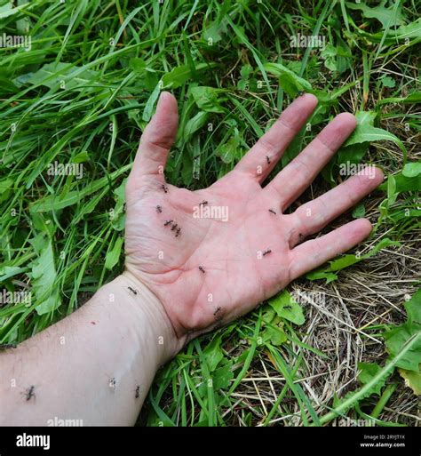 Hand Of Person With Black Ants Above That Bite And Sting And Cause