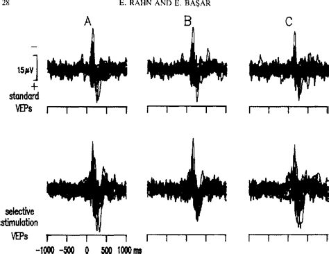 Figure 3 From Enhancement Of Visual Evoked Potentials By Stimulation During Low Prestimulus Eeg