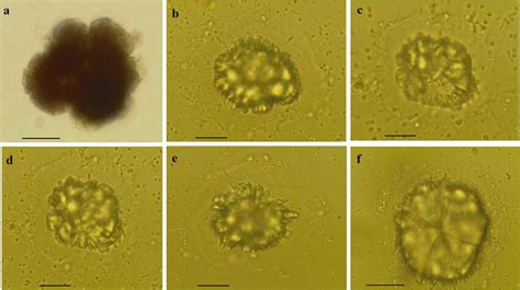 Botryococcus Braunii From Lake No 1 Borkowskie A Normal Colony Download Scientific