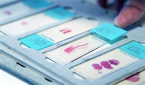 Microscopy Biological Sciences Matlab And Simulink Solutions