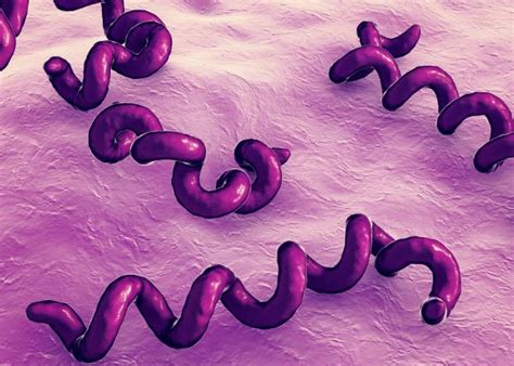 感染梅毒后，身体会有这3大异常，要尽快做检查 12健康