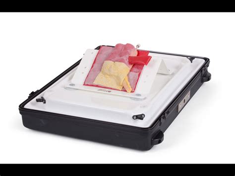 Vermiform Appendix Normal Anatomy Limbs And Things Global