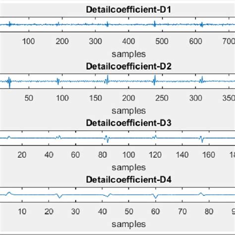 Detailed Coefficients Using Dtcwt At Different Levels Up To The Fourth Download Scientific