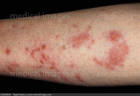 Stock Image The Inner Wrist And Arm Of A Sixty Year Old Woman With
