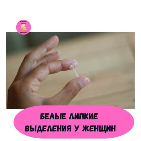 Белые липкие выделения из влагалища у женщин причины виды