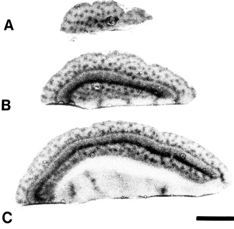Figure 1 From Functional Anatomy Of Macaque Striate Cortex Iii Color Semantic Scholar