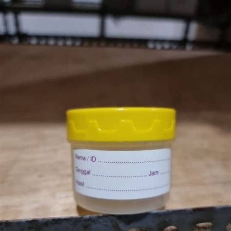 Jual Pot Sputum Pot Dahak Pot Urine Container 60ml Shopee Indonesia