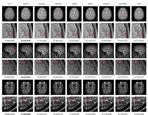 Visual Effects Under Bicubic Degradation The Maximal Psnr Db And Download Scientific Diagram
