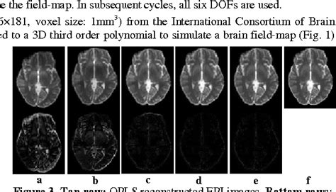 Figure 3 From Concurrent Geometric Distortion Correction In Mapping Slice To Volume Msv