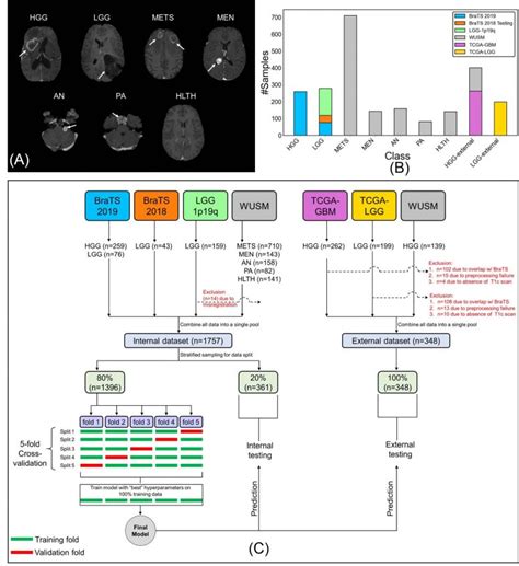 人工智能通过单次 MRI 扫描对脑肿瘤进行分类 中国核技术网