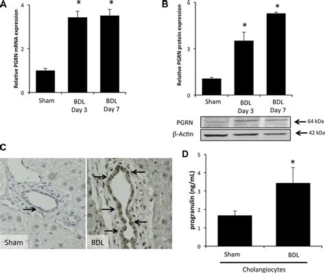 Progranulin Pgrn Expression And Secretion Are Increased In