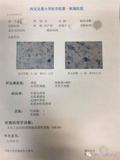 液基细胞学检查薄层大山谷图库